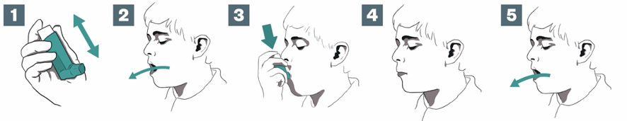 Teknik Gunakan Inhaler yang Tepat pada Asma – Dokter Imun