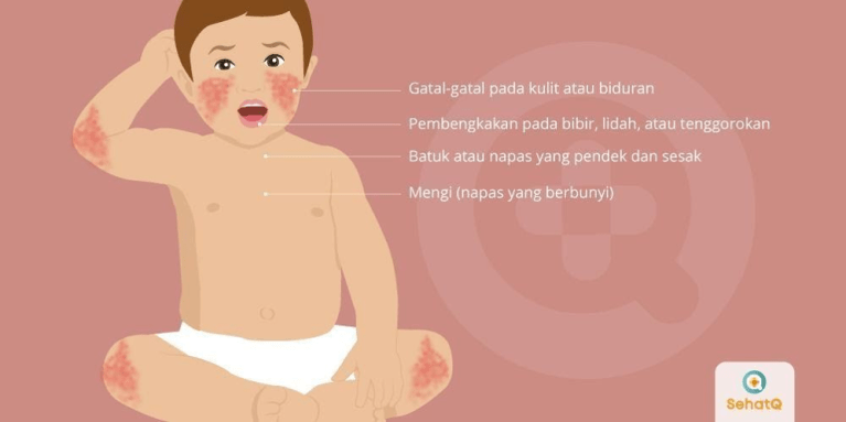 Tips Mengenali dan Mengendalikan Alergi Susu Sapi – Dokter Imun
